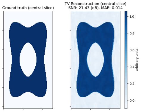 3d Tv Regularized Sparse View Ct Reconstruction Scico 005 Documentation