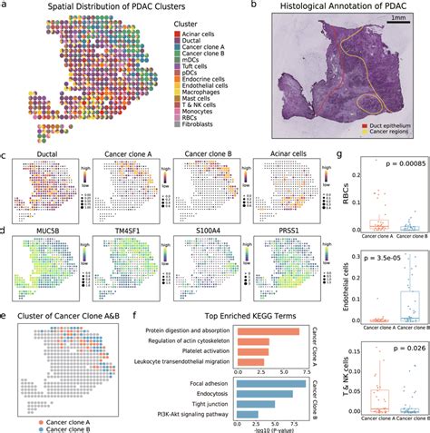 Uniport Identifies Distinct Cancer Subtypes In Microarray Based Spatial