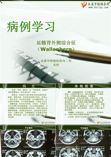 延髓背外侧综合征病例分析ppt模板 卡卡办公