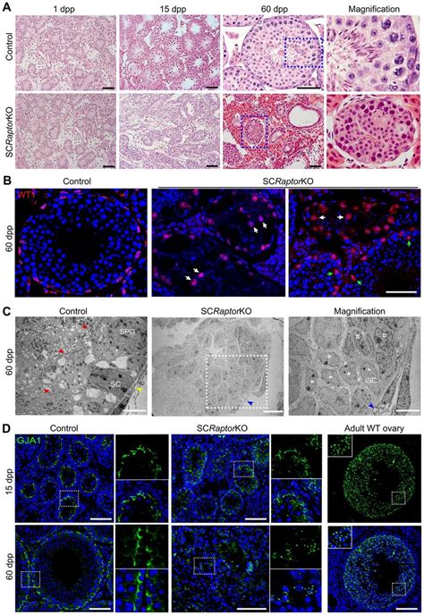 Testicular Organization And Cell Architecture Were Impaired In