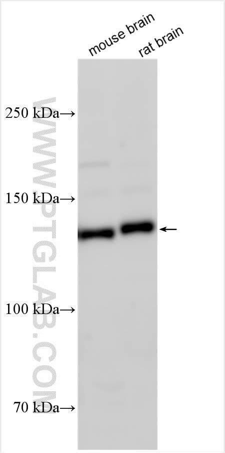 Trappc10 Antibody 27549 1 Ap Proteintech