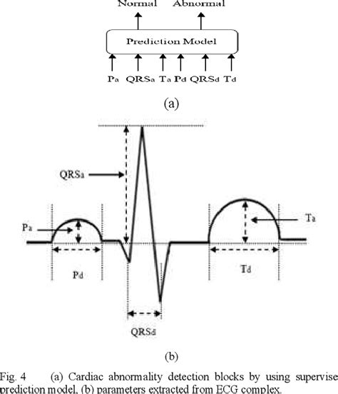 Figure 2 From Prediction Of Ecg Cardiac Abnormality Signal Using Supervised Prediction Model