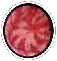 A Compreens O Hemostasia Por Deu E Rp Guides Online