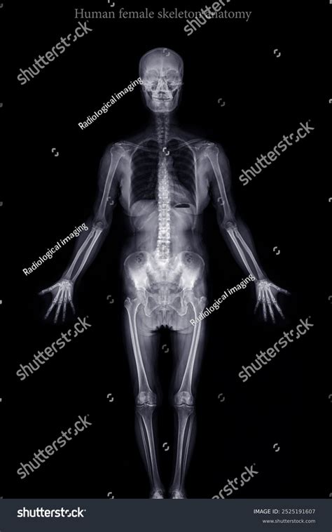 X Ray Body X Ray Body Images Free Download On Freepik