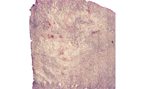 Using Spatial Annotations • Spata2