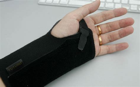Difference Between Brace And Splint At Ella Kendall Blog