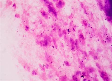 Lactobacillus Bulgaricus Banco De Fotos E Imágenes De Stock Istock