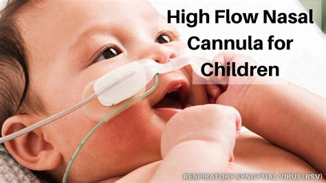 Nasal Cannula Placement