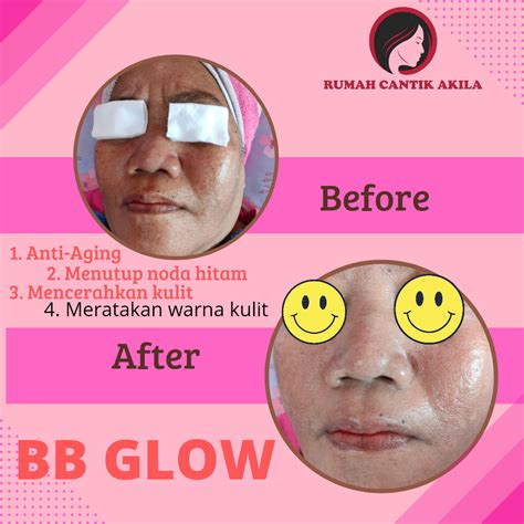 Drw Skincare Drw Skincare Rizka Sophiarosy Gorontalo