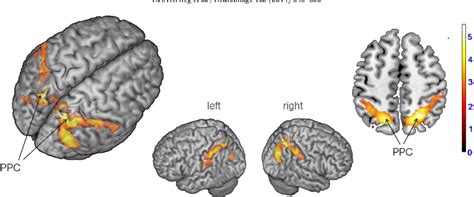 Figure 4 From Functional Magnetic Resonance Imaging Of Sensorimotor Transformations In Saccades