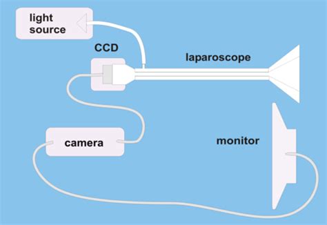 Ls4 Imaging System Setting Up Laparoscopy Stack Flashcards Quizlet