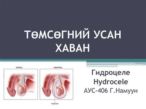 цус алдалтыг тогтоох Ppt