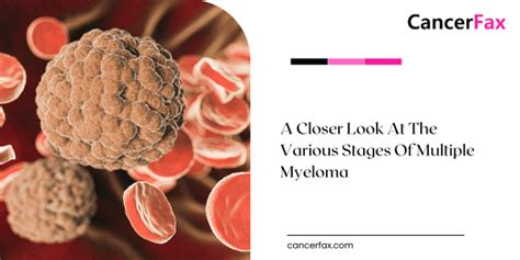 What Are The Stages And Types Of Multiple Myeloma