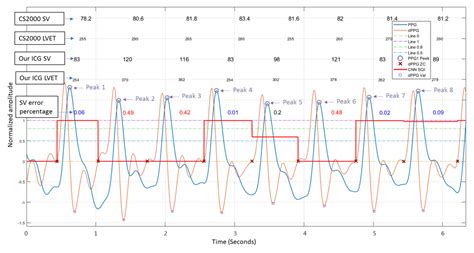 Applied Sciences Free Full Text Classification Of Photoplethysmographic Signal Quality With