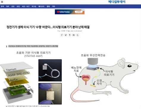 정전기가 생체 이식 기기 ‘수명 바꾼다이식형 의료기기 분야 난제 해결 Articles 연세대 김상우교수님 연구실