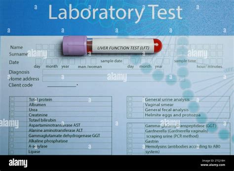 Liver Function Test Tube With Blood Sample On Laboratory Form Top