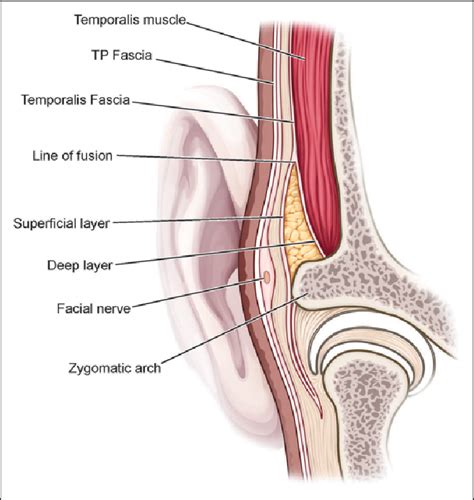 Surgical Anatomy Of The Temporal Region Notice The Location Of The Download Scientific Diagram