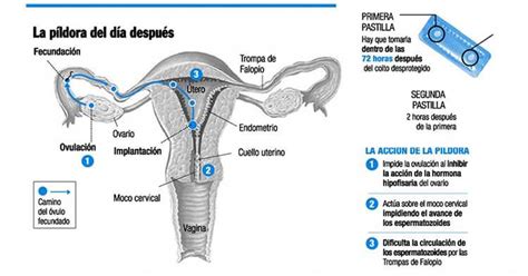 CÓmo Saber Si La Pastilla Del DÍa Siguiente FuncionÓ