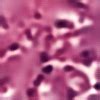 Randomly Selected Examples Of Unsupervised Nucleus Detection And