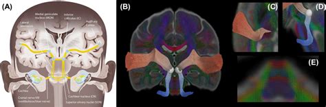 Auditory Pathway Anatomy A Schematic Of The Ascending Auditory