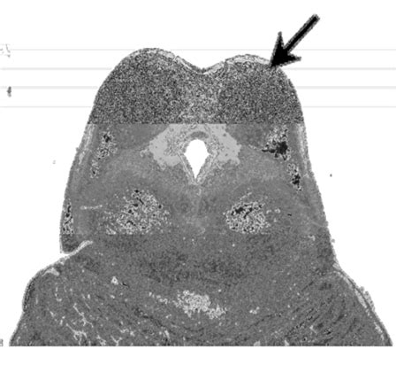 Final Practice Exam Flashcards Quizlet