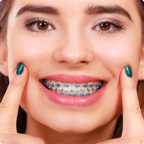 Orthodontic Braces Myo Medical Center