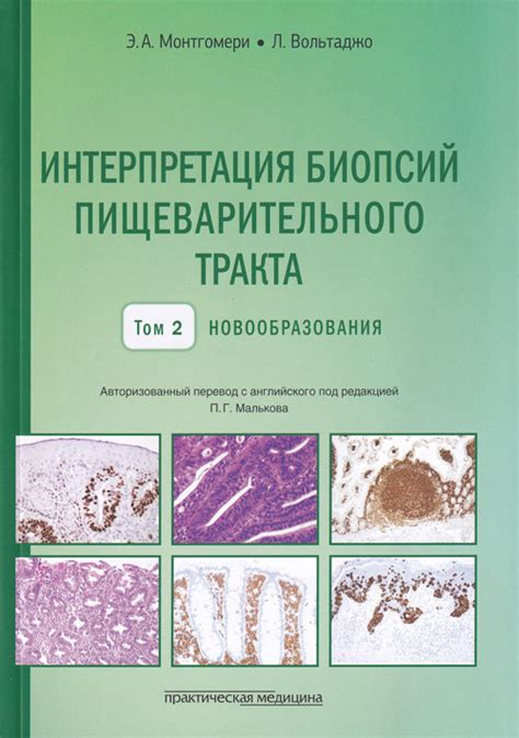 «Патологическая анатомия. Учебник» Струков А.И., Серов В.В.; Под ред. В ...