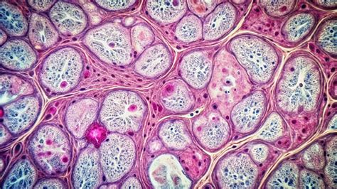 Light Microscope Histology Liver Health Liver Biopsy Liver Cirrhosis