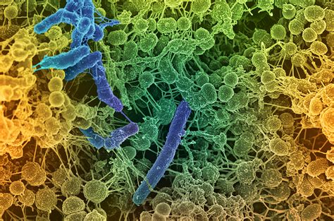 Powerful Physics Tool Could Help Scientists Understand Complex Ecosystems Science AAAS