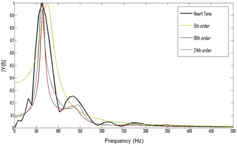 A S3 Heart Tone And Lpc Filter Spectra A Comparison Between A Real S3 Download Scientific