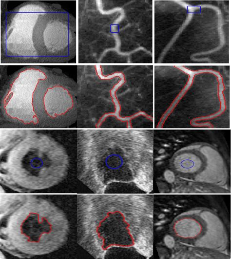 segmentation results of medical images the first and third rows