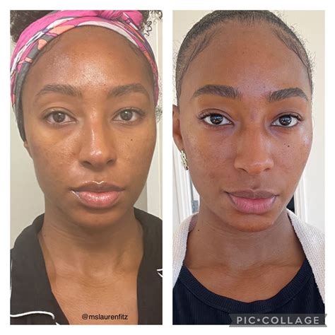 Best 12 Before And After Results Of Using The Aloe Gua Sha Try It Now