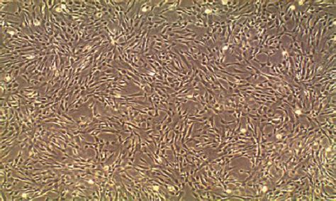 Cell Surface Markers And Differentiation Capability Of Ucmscs Cell
