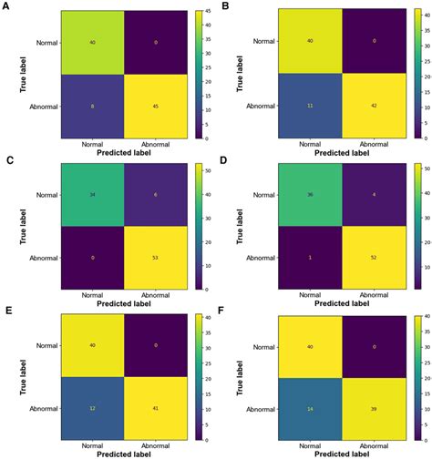Confusion Matrix Of Diagnostic Results A Confusion Matrix Of Manual Download Scientific