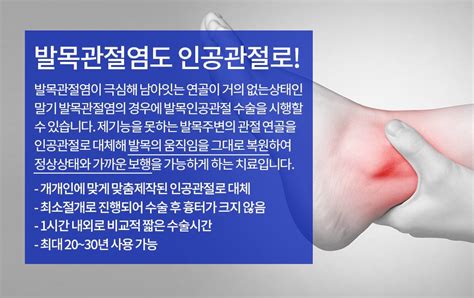 조은마디병원 무릎의 관절염은 주로 노화로 인한 퇴행성 질환으로 50~60대 이상의 환자에게서 많이