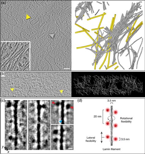 Cytoskeleton Electron Micrograph