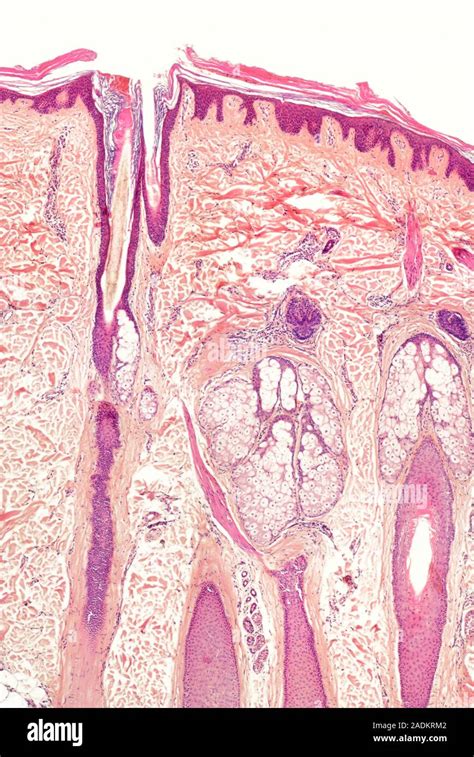 Human Skin Light Micrograph Of A Section Through Healthy Human Skin