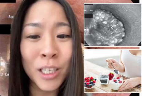 Thepatriotlight Doctor Issues Warning Over Eating Dry Chia Seeds