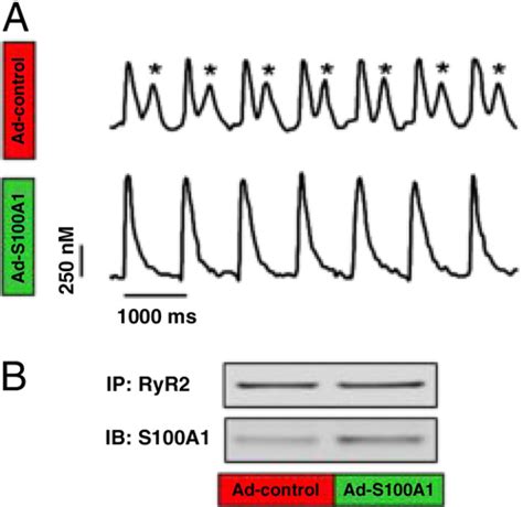 S100a1 Genetically Targeted Therapy Reverses Dysfunction Of Human Failing Cardiomyocytes Pmc