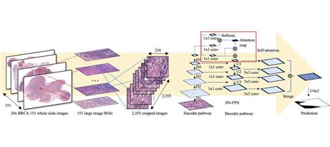Sai Ramya Sri Mamillapalli On Linkedin Sn Fpn Self Attention Nested Feature Pyramid Network