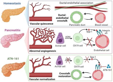 研究建立胰腺炎疾病和靶向药物细胞谱系—论文—科学网