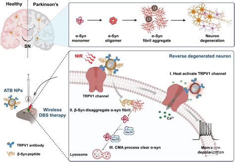 【风向标｜研究】一种基于纳米粒子的无线脑深部刺激系统可逆转帕金森病！中国团队在帕金森病治疗领域取得又一突破性进展！ 脑医汇