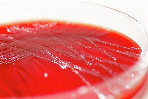 Cultured Enterococcus Faecium Bacteria Photograph By Science Photo Library Pixels Merch