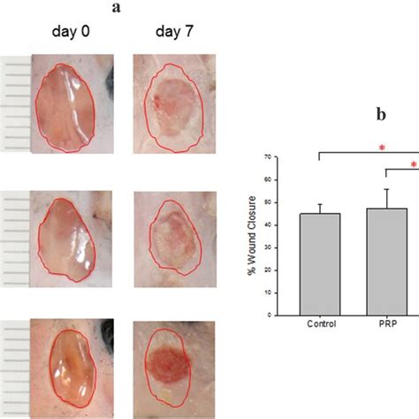 Re Epithelialization Of Wounds Wounds Without Treatment A