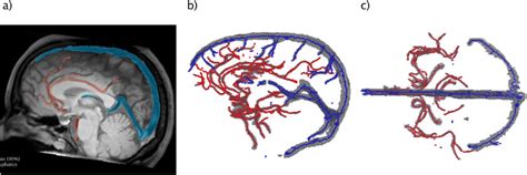 Workflow Of Generating Bf Path Lines A Intensity Based Segmentation