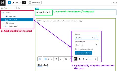 Create Custom Archive Template In Kadence Theme