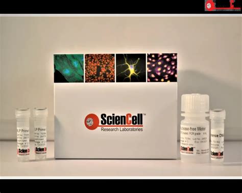 Human Global Dna Methylation Quantification Qpcr Assay Kit Hgdm