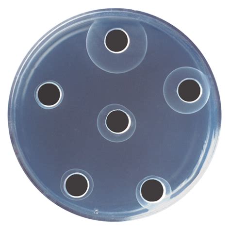 Immunodiffusion Wikipedia