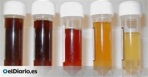 ¿qué Nos Dice El Color De La Orina Sobre Nuestra Salud