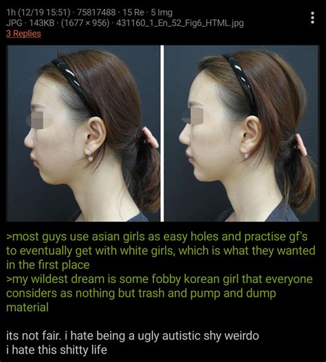 Garbage Collector R Greentext